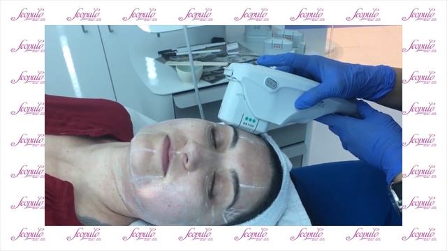 Сравнение аппаратов: SMART HIFU или ARVOKA HIFU? | Scopula.ru