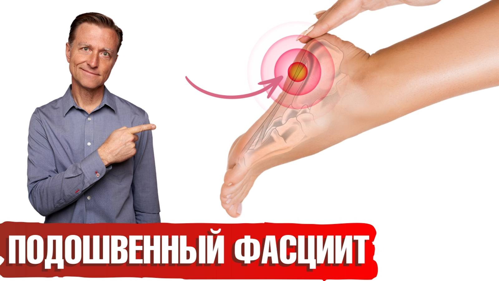 Боль в ступне: что делать? Плантарный фасциит 👉 есть решение