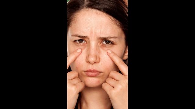 Избавляемся от отёчности под глазами