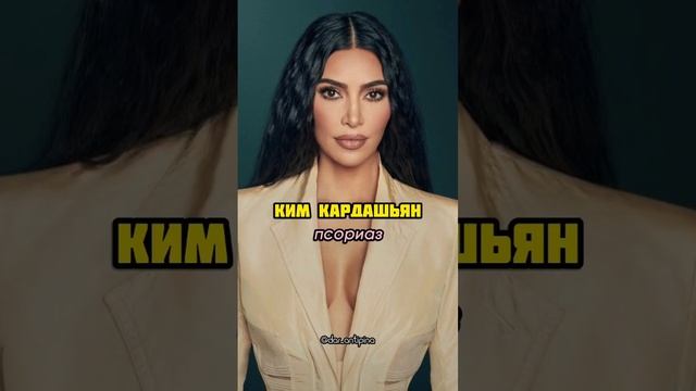 5 знаменитостей, которые столкнулись с аутоиммунными заболеваниями, как и я | часть 2