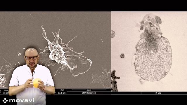 курс PRF создан специально для портала OHI-S.