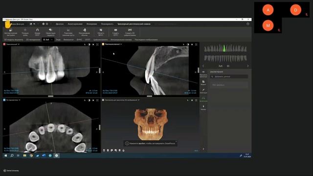 Вебинар DEXIS  Инновационное ПО DTX Studio Clinic с интеллектуальным помощником в практике