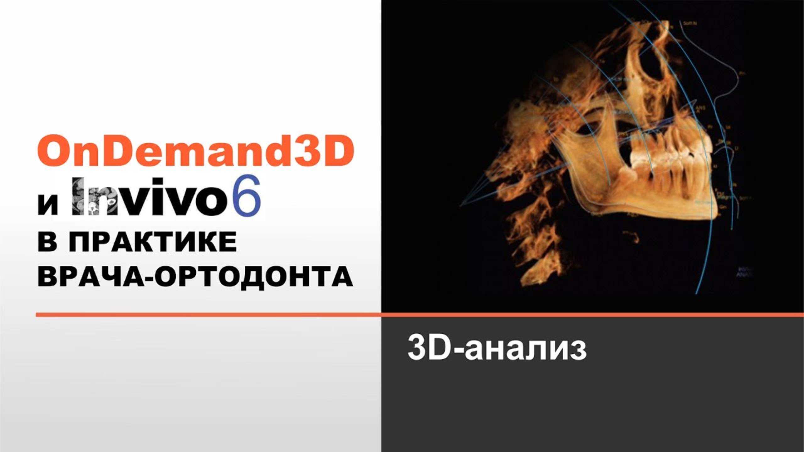 Invivo 6 и OnDemand3D Dental в практике врача-ортодонта. 3D-анализ