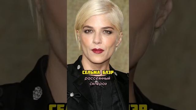 5 знаменитостей, которые столкнулись с аутоиммунными заболеваниями, как и я / часть 6