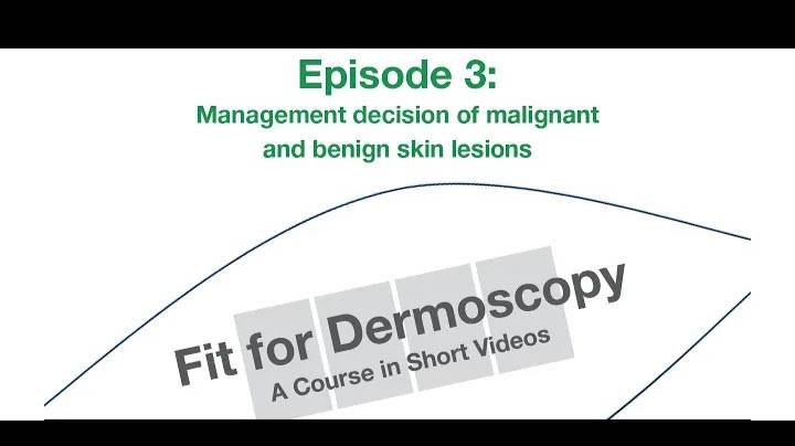 Эпизод 3 - Решение о лечении злокачественных и доброкачественных поражений кожи