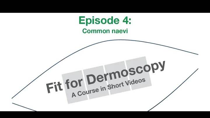 Эпизод 4 -  Обычные невусы