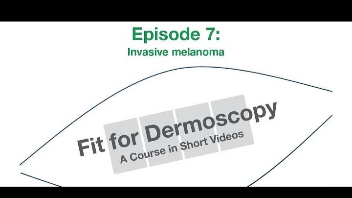 Эпизод 7 – Инвазивная меланома