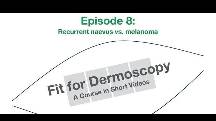 Эпизод 8 – Рецидивирующий невус  vs меланома