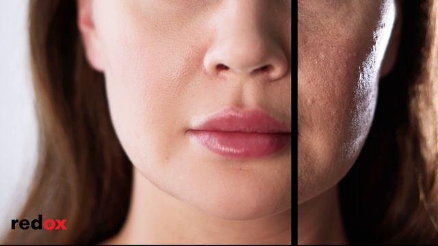 До и после - альгинатные маски redox