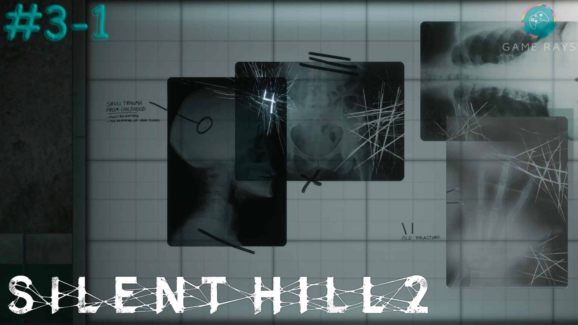 Silent Hill 2 Remake #3-1 ➤ Рентгенограмма