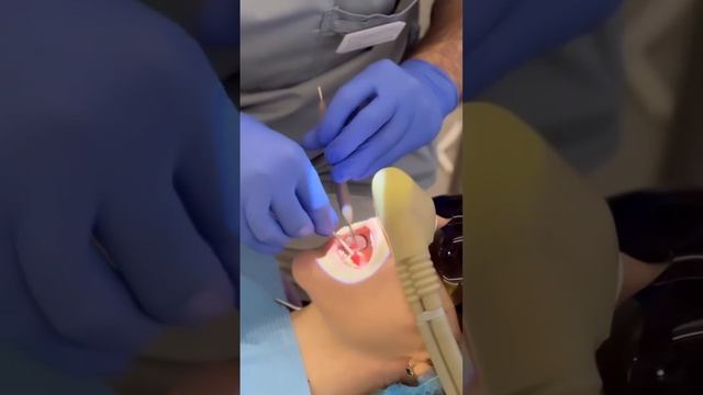  Нежное удаление зуба