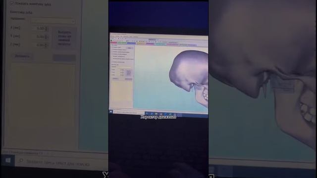 ♀️ Как избавиться от боли, хрустов и скрежетания с височно - нижнечелюстным суставом❓