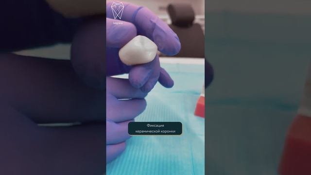 Имплантация зубов - что это такое?