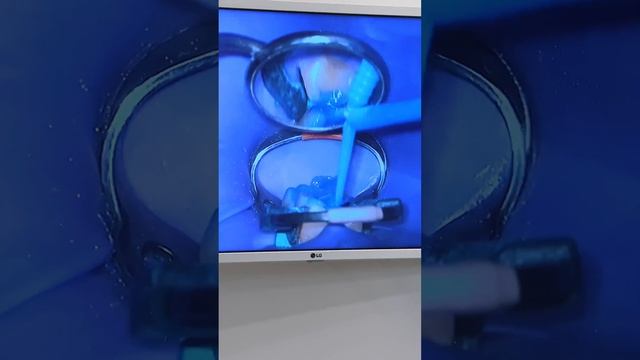 Замена старых пломб на новые. Клинический случай Belgravia Dental Studio