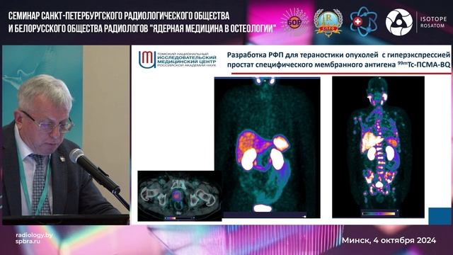 Перспективные радиофармпрепараты для визуализации костных метастазов при раке предстательной железы