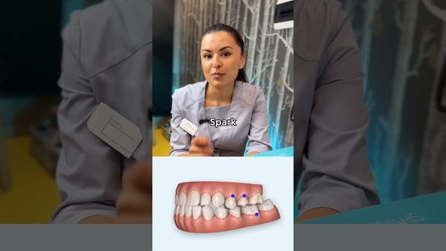 Элайнеры Spark - путь к красивой улыбке. Ровные зубы без брекетов