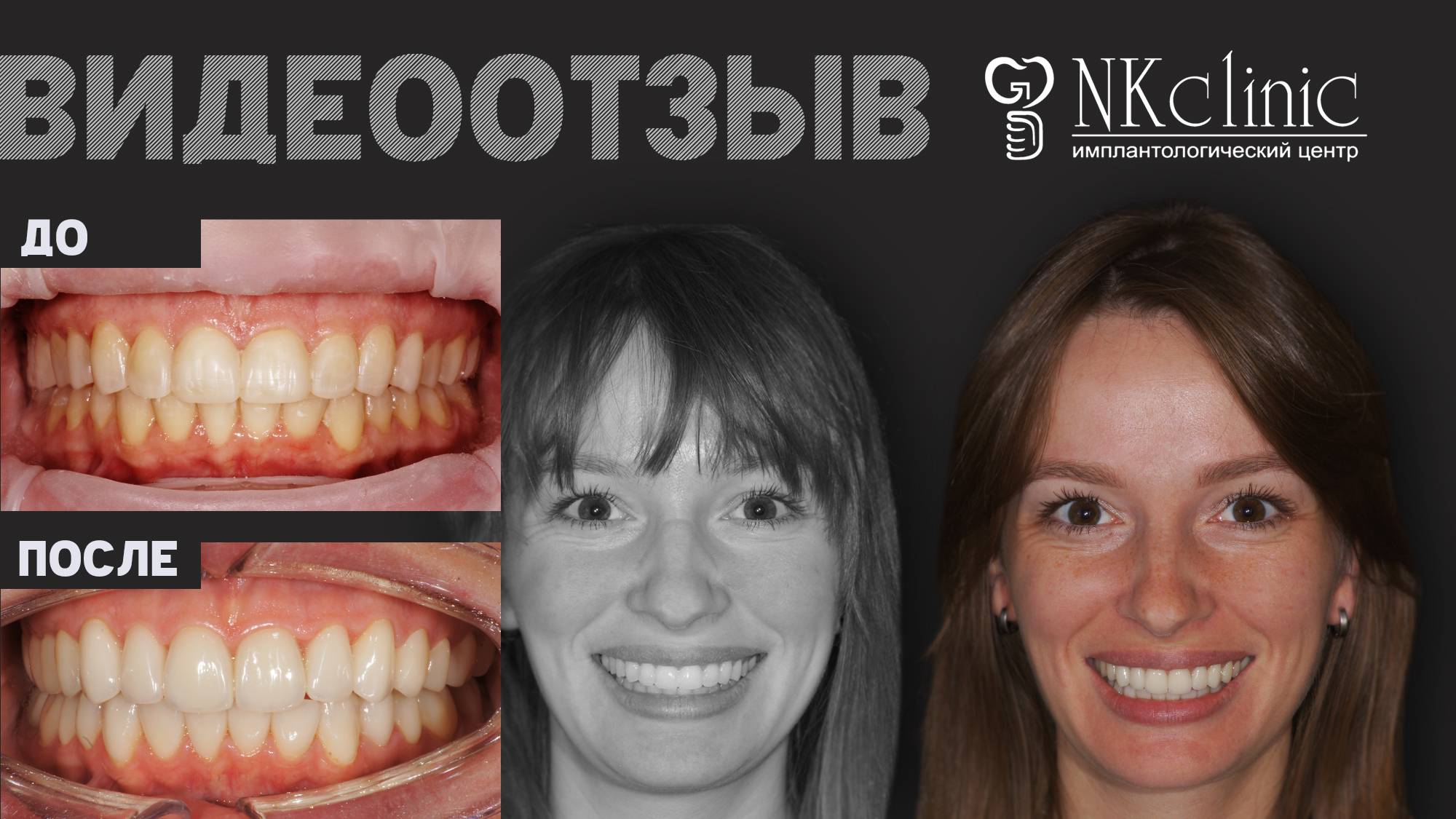 NKclinic - отзывы пациентов. Избавили от боли в челюсти без операции.
