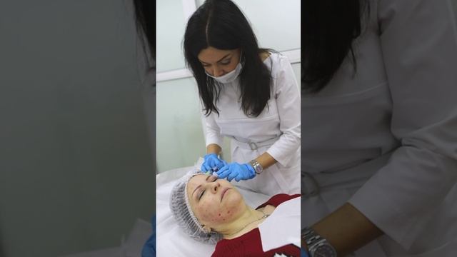 Биоревитализация препаратом Дермахил HSR