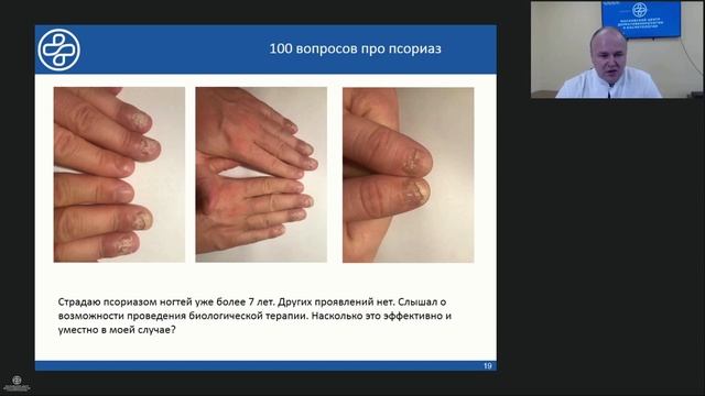 «100 вопросов про псориаз»
