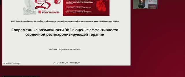 Современные возможности ЭКГ в оценке эффективности сердечной ресинхронизирующей терапии