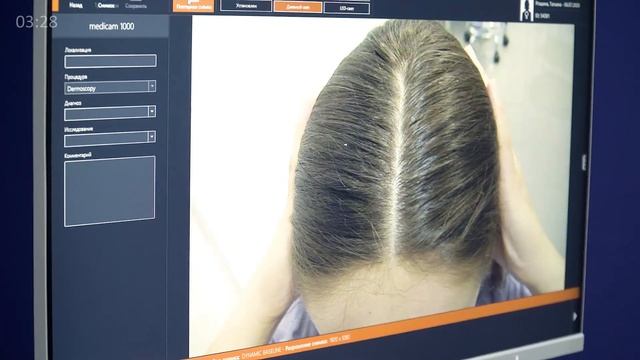 Эффективное лечение выпадения волос - алопеции. В чём секрет. МНПЦ Дерматовенерологии и Косметологии