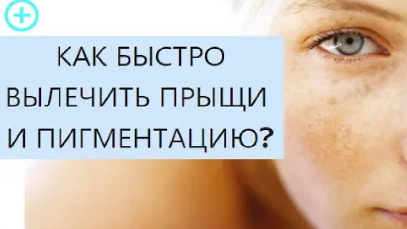 КАК БЫСТРО ВЫЛЕЧИТЬ ПРЫЩИ И ПИГМЕНТАЦИЮ?