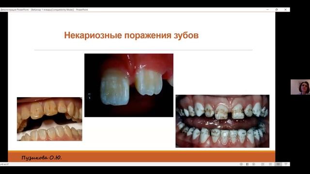 Запись прямого эфира  Что нужно знать родителям о заболеваниях полости рта