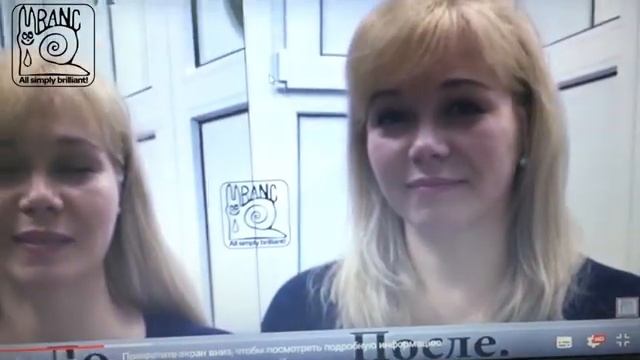 № 952. Метод RANC при последствиях инсульта. Отзывы на 2-х Курсах лечения.