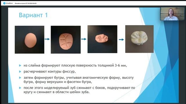 7. Варианты моделирования жевательной поверхности зубов.