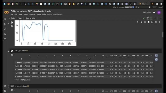 Нейронные сети - пример нейронной сети для классификации аритмии по ЭЭГ