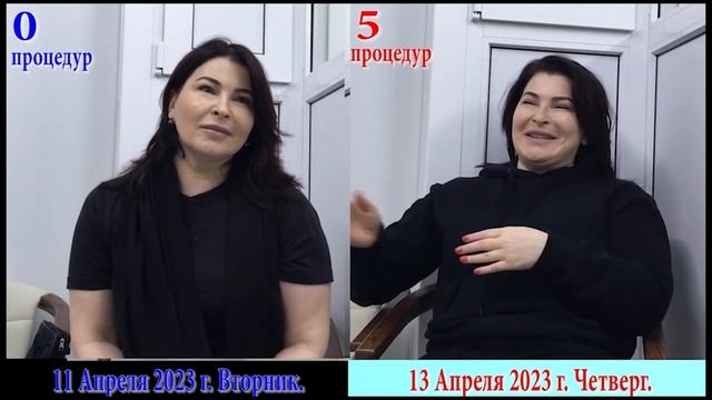 № 1174. Анонс видео № 1175  "ЛОМКА - 7/1" О лечении Тройничного нерва, Омоложении лица и тела.