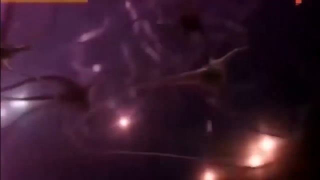 730.Головная боль мучила 50 лет. Отзыв о лечении методом RANC.