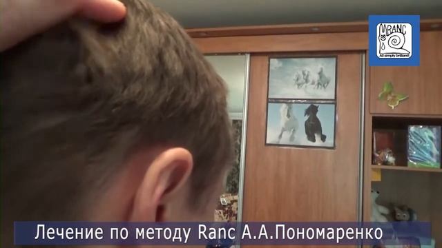 540. ПСОРИАЗ ЛЕЧИТСЯ МЕТОДОМ RANC! Воронеж