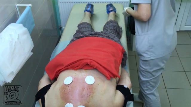 № 1007. Российский Метод лечения RANC. Две беседы на 10-дневном Курсе + видео процедуры "дуплекса".