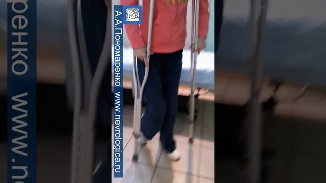 426. РЕВМАТОИДНЫЙ АРТРИТ. Отзыв о лечении методом RANC/