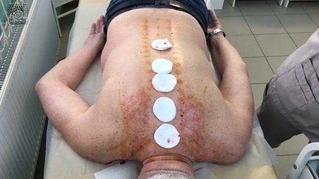 №1081  Метод RANC, Б,Паркинсона, Суставы, и Тройничный. "Начало Мая 2021 года". Заключительная часть