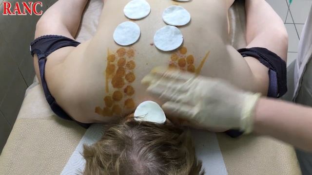 № 1141. О Методе RANC + Схема выполнения процедуры, Январь 2023.