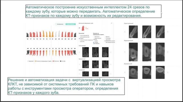1. Доклад Соловых. (Dentomo) Технология для автоматического анализа КЛКТ в стоматологии.