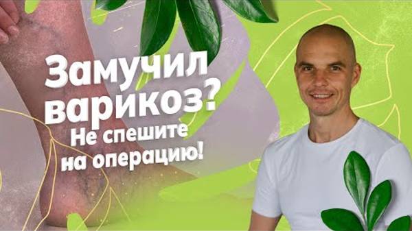 Причина варикоза. Избавление от варикоза без операции