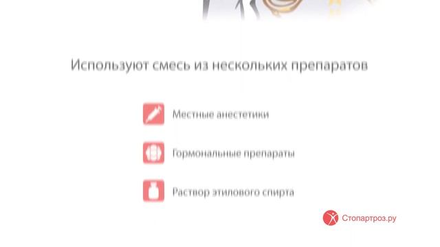 Блокада межреберных нервов в клинике Стопартроз