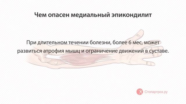 Что такое медиальный эпикондилит?