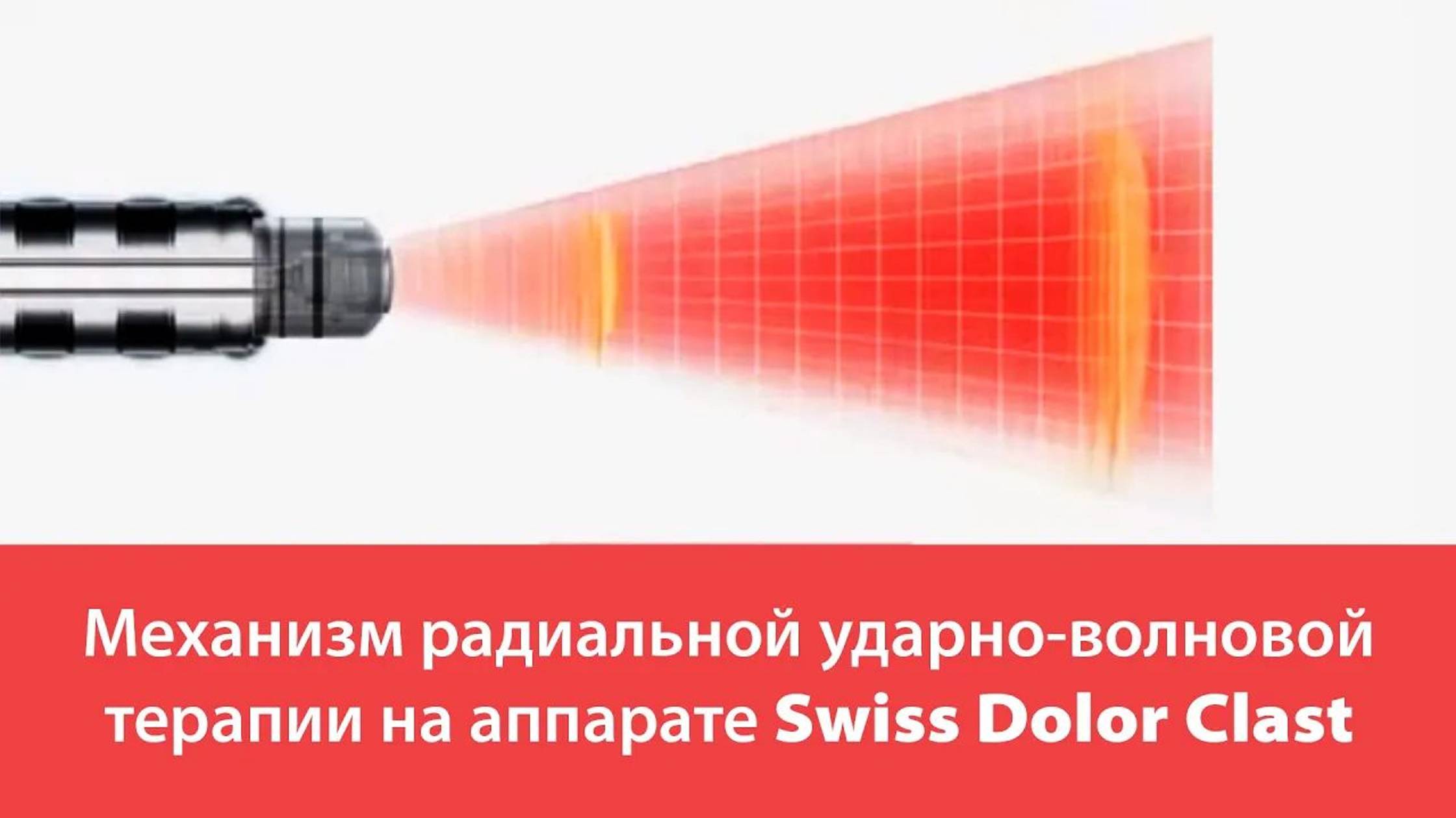 Механизм радиальной ударно-волновой терапии на аппарате Swiss Dolor Clast