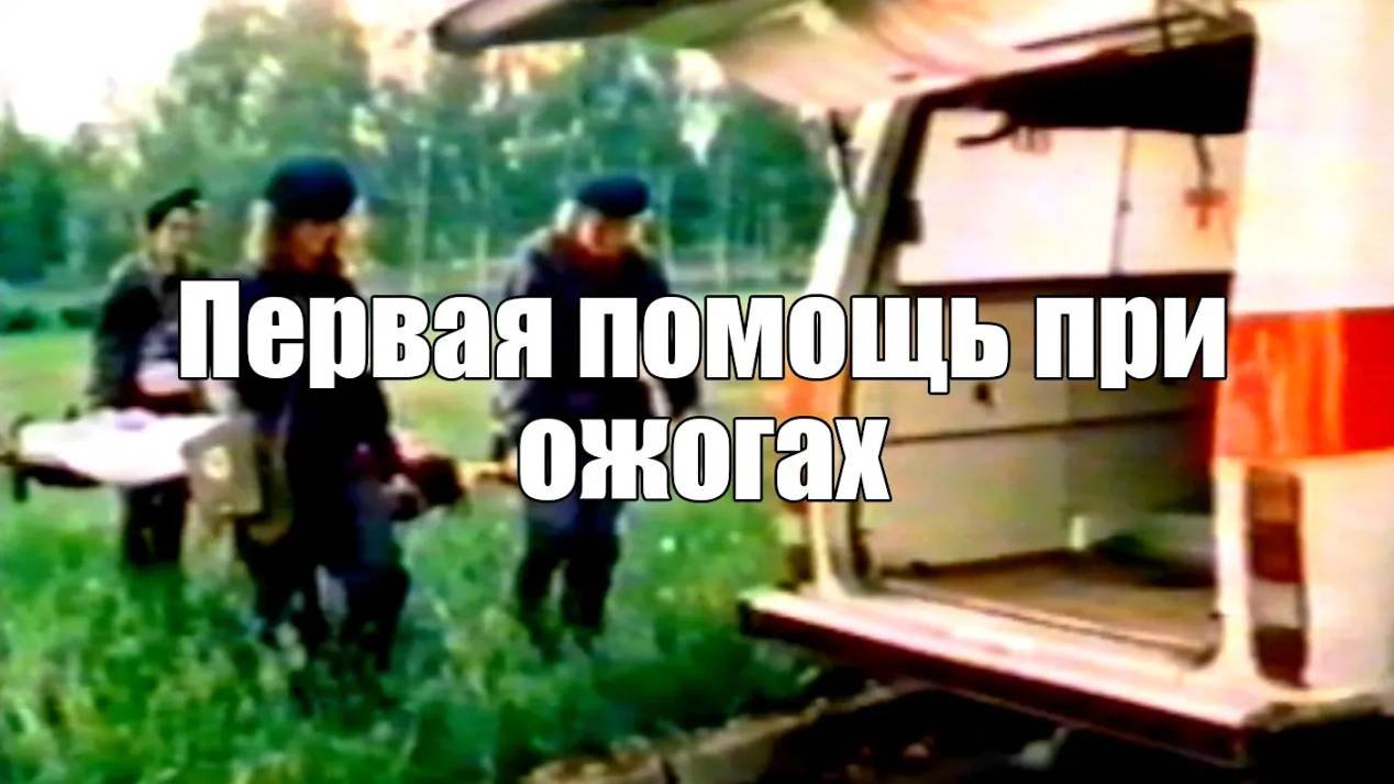 Первая помощь при ожогах
