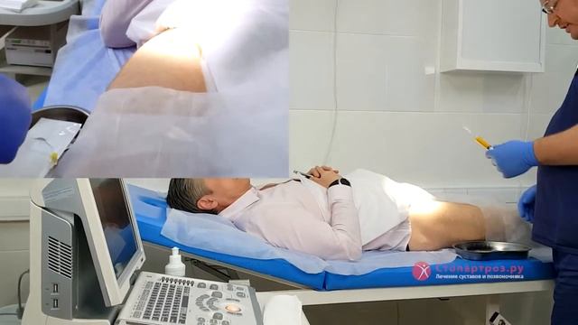 Плазмолифтинг тазобедренного сустава: больно или нет?