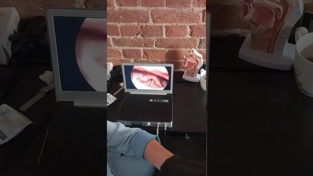 Мои ГОЛОСОВЫЕ СВЯЗКИ😅 #вокальныйпедагог #урокивокала #микст #фальцет #фониатр #albinawhiteberry