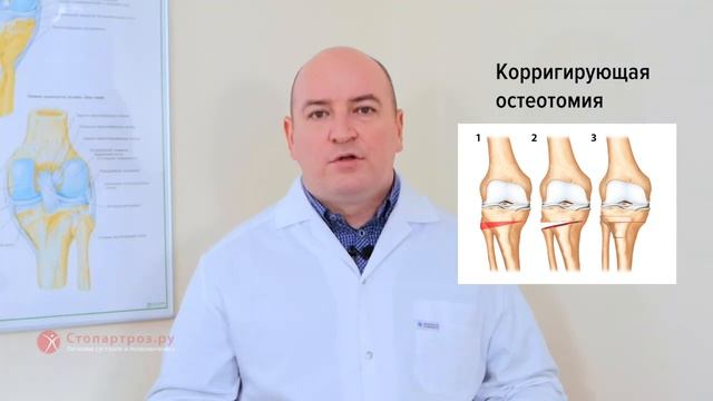 Хирургические методы лечения артроза коленного сустава