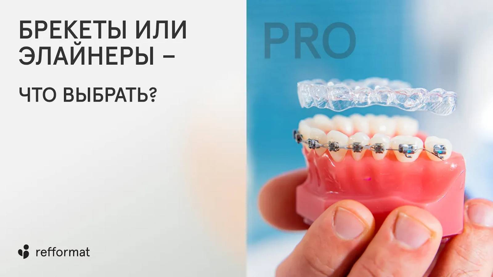 👀 Элайнеры или брекеты: что лучше?