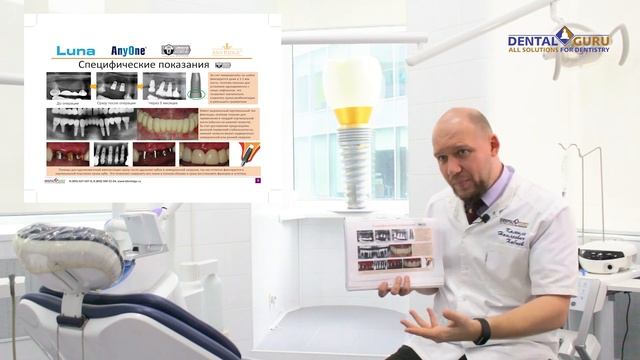 36. Какой имплантат выбрать_ Доступно о сложном.