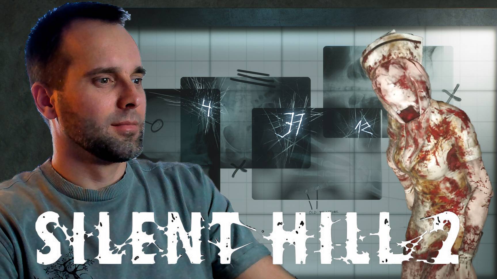 ПСИХ ЛЕЧЕБНИЦА И МЕДСЕТРЫ! ► Silent Hill 2 REMARE 2024 #10