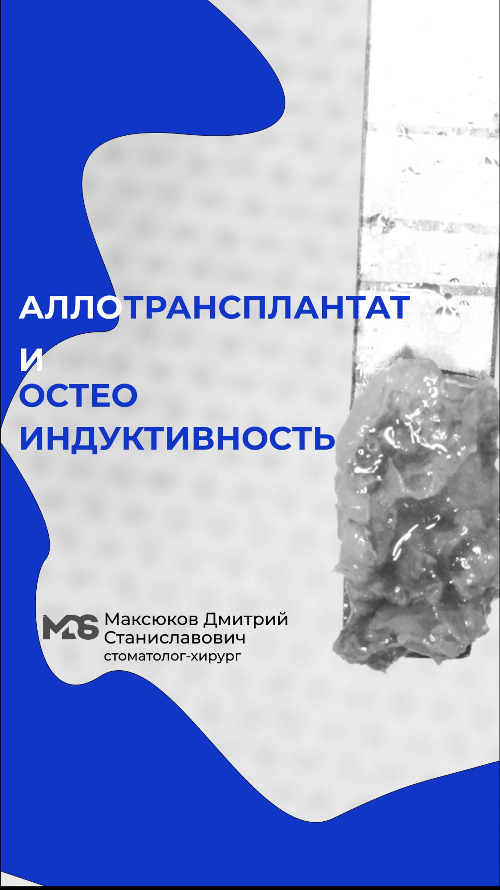 Имеют ли аллотрансплантаты остеоиндуктивные свойства ?